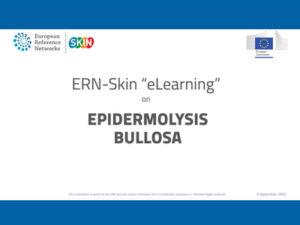 ERN Skin – European Reference Network for rare skin diseases
